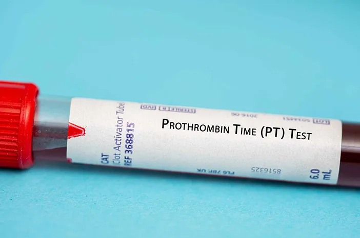 Cek Prothrombin Time (PT): Pengertian, Manfaat, dan Prosedur | Halodoc