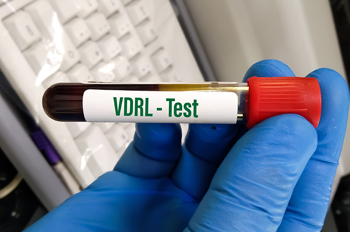 Cek Syphilis (VDRL/RPR) - Tujuan, Prosedur, & Interpretasi Hasil