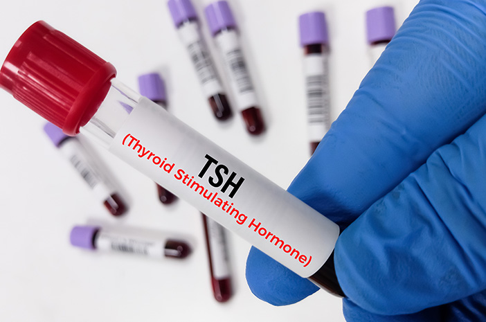 Cek Thyroid Stimulating Hormone-sensitive (TSHs) - Tujuan & Prosedur