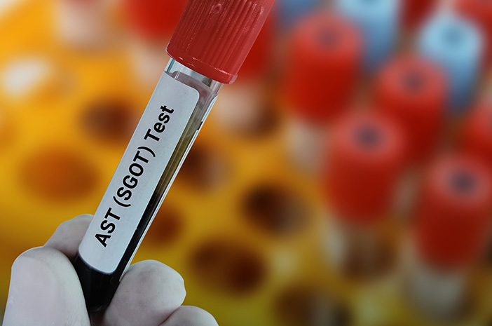 Pemeriksaan SGOT/AST - Tujuan, Jenis, dan Prosedur | Halodoc