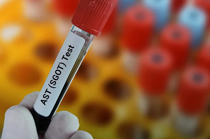 Pemeriksaan SGOT/AST - Tujuan, Jenis, dan Prosedur | Halodoc