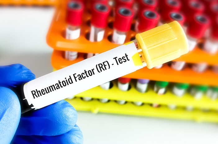 Cek Rheumatoid Factor (RF): Pengertian, Manfaat, dan Prosedur | Halodoc