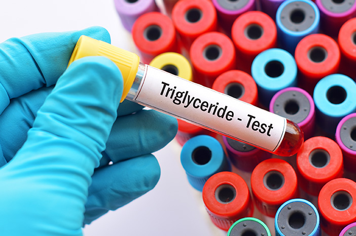 Trigliserida: Pengertian, Fungsi, dan Cara Menurunkannya