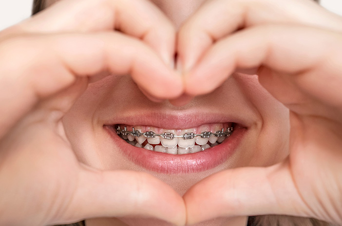 Behel Gigi Terdekat: Harga, Lokasi, dan Panduan Lengkap