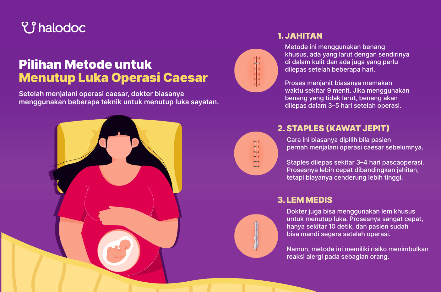 Tanda Jahitan Caesar Bagian Dalam Sudah Kering: Ini Tandanya
