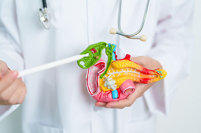 Ini Ciri Batu Empedu Parah yang Perlu Diwaspadai