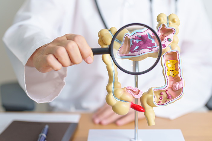 Tumor Usus: Ini Gejala, Penyebab, Pengobatan, dan Pencegahan