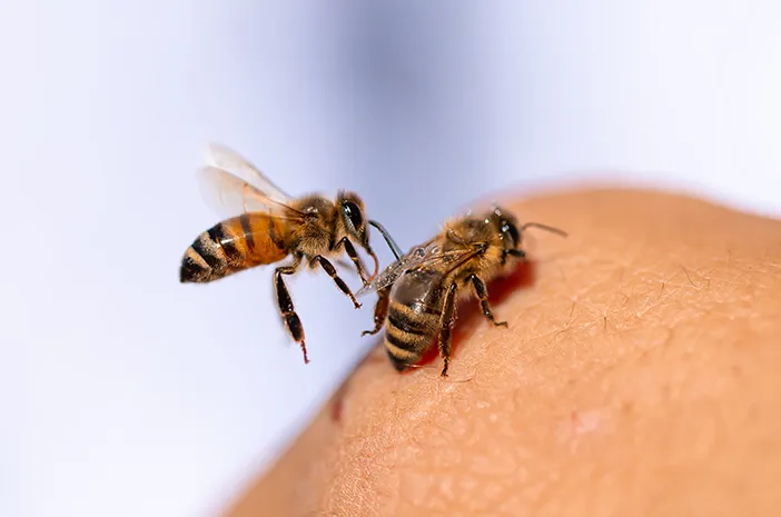 Ini Pengobatan Sengatan Lebah yang Tepat dan Aman