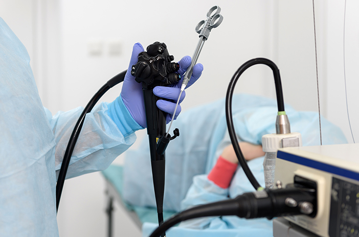 Ini 10 Jenis Endoskopi Berdasarkan Organ Tubuh yang Diamati