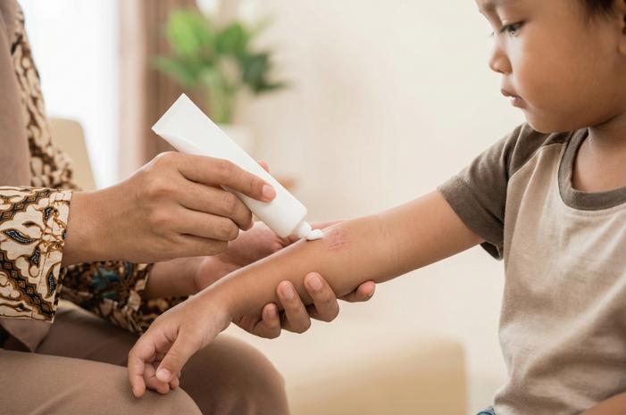 Cicaplast Kuatkan Skin Barrier Redakan Iritasi