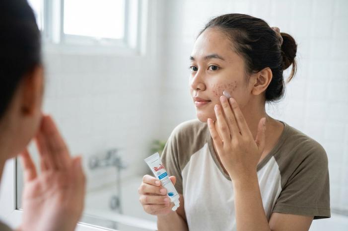Verile Ampuh Atasi Bekas Jerawat? Ini Review Jujurnya