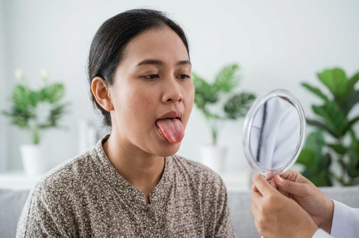 Atrofi Papil Lidah: Kenapa Lidah Jadi Halus Licin?